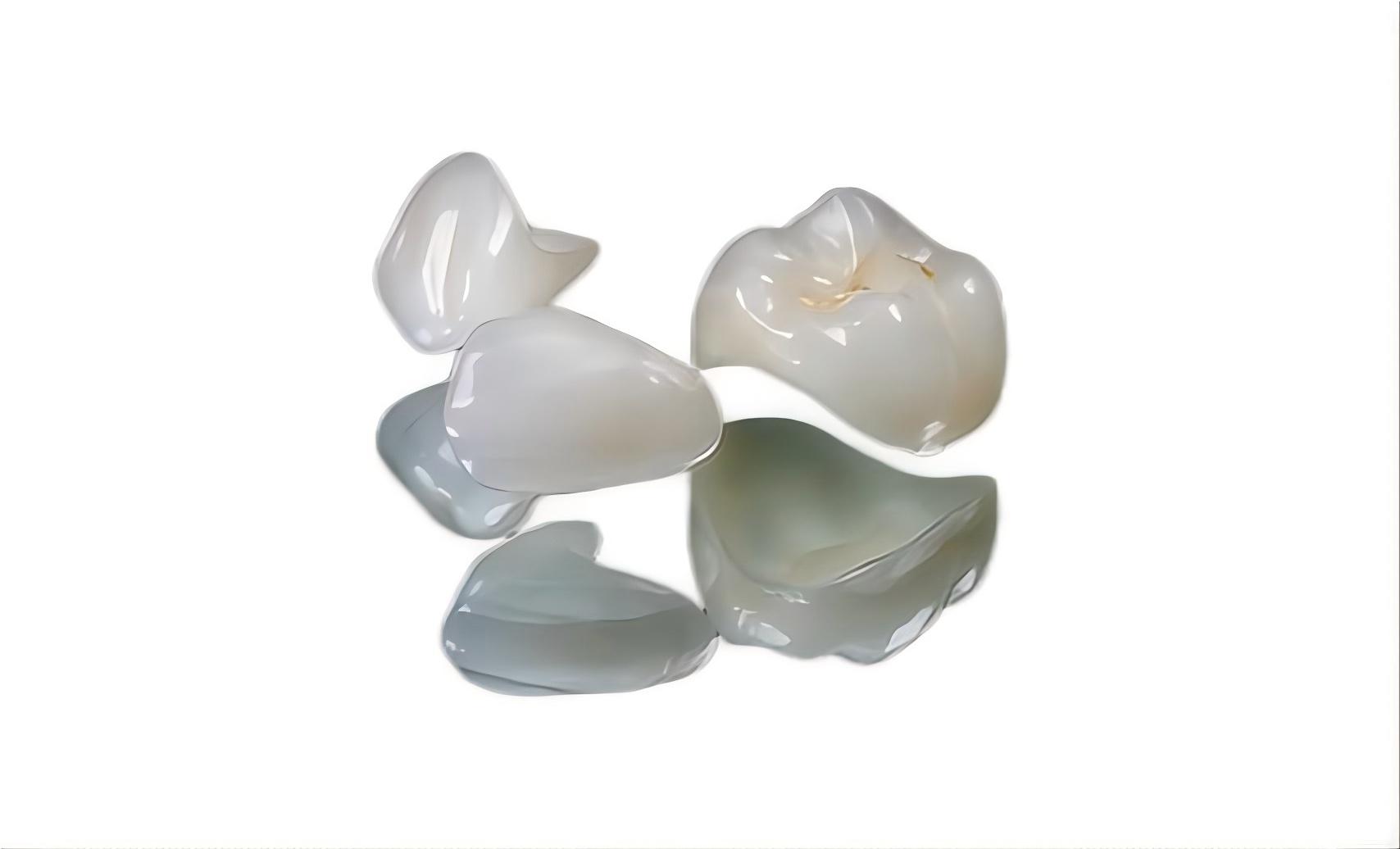 E-Max - Pros Dental Lab